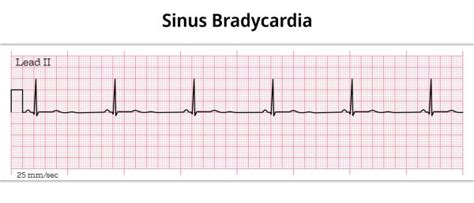 Suspected Stroke Algorithm Safety Training Seminars
