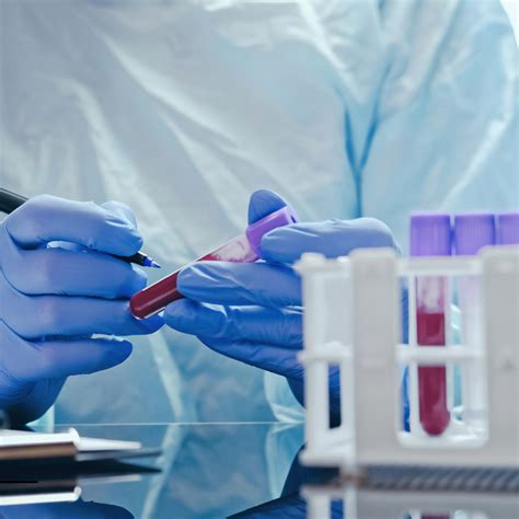 Simple Diagnostics For Common Diseases Hibernia Medical