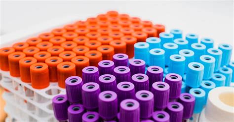 Exame Cpk Para Que Serve Referência E Quando Fazer