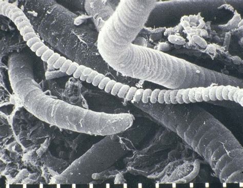 Sem Micrograph Of A Section Of A Microbial Mat From The Mellum