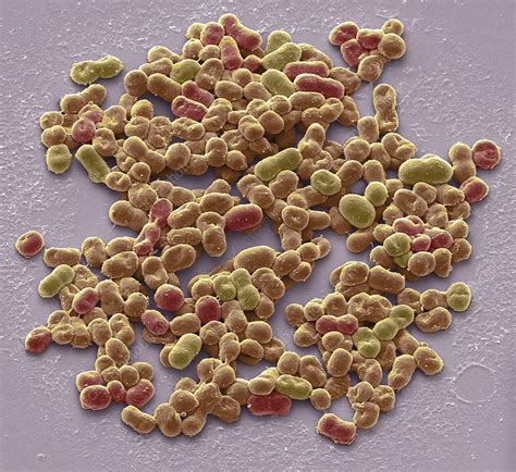 Azotobacter Chroococcum Sem Stock Image C0390709 Science Photo