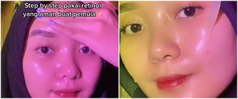 Step By Step Pakai Retinol Untuk Pemula Aman Dan Nggak Bikin Iritasi