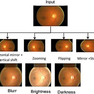 Samples Generated By Data Augmentation Download Scientific Diagram