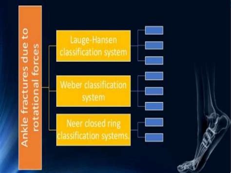 All Types Of Ankle Fracture By Kajal Ppt