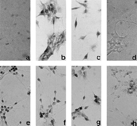 Non Radioactive In Situ Hybridization Of Metabotropic Glutamate Download Scientific Diagram