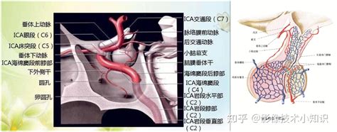 鞍区mri影像解剖 知乎