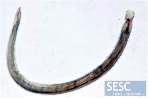 Observación De Una Larva Hembra De Strongylus Edentatus Con La Lupa