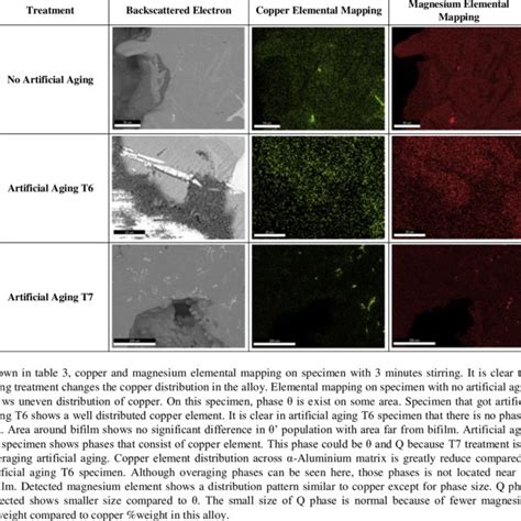 As Cast Microstructure Of Hadfield Steel Austenitic Matrix With