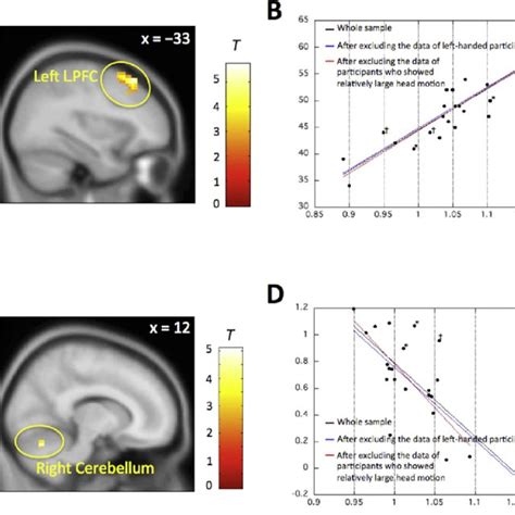 Regions Showing Spontaneous Brain Activity Associated With Explicit Or Download Scientific