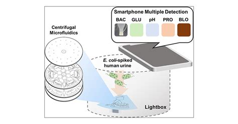 Hand Powered Point Of Care Centrifugal Microfluidic Platform For Urine