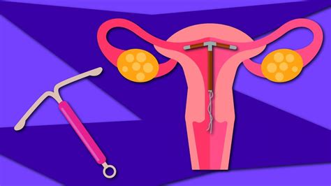 ¿cómo Funciona El Diu Salud Facmed