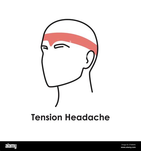 Tension Headache Color Icon Vector Isolated Illustration Migraine