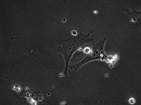 How Can We Distinguish The Normal Fibroblast And Senescent Fibroblast In The Culture Researchgate
