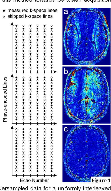 Figure From Nonlinear Inverse Reconstruction For T Mapping From