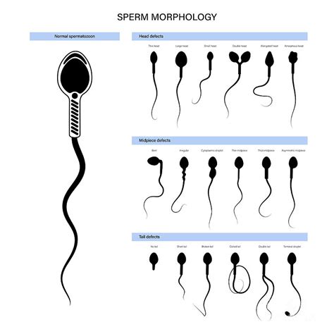 Sperm Morphology Photograph By Science Photo Library Pixels Merch