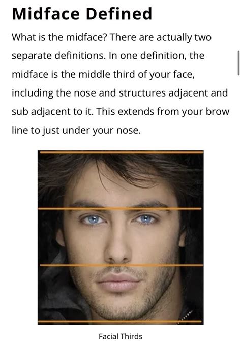 Midface Defined Facial Fillers Facial Aesthetics Facial Bones