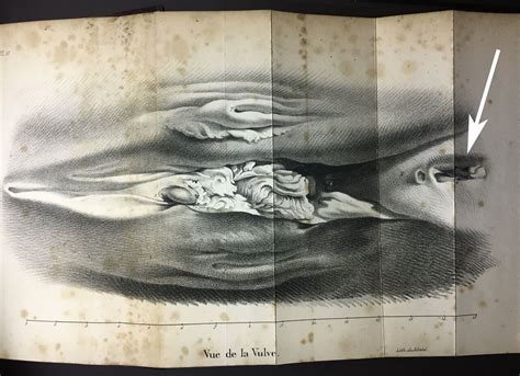When Memes Fail Anatomy The Scale Of A Blue Whales Butthole Ars Technica