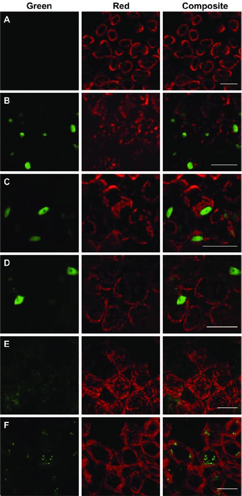 Characterization Of The Nuclear Localization Signal For Slspl Cnr A