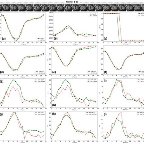 The Schematic Illustration Of Our Left Ventricle Segmentation Network Download Scientific