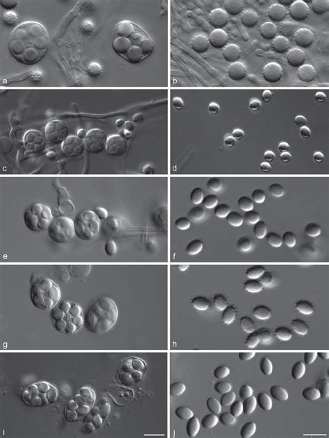 Variations Of Asci And Ascospores Produced By Different Species In