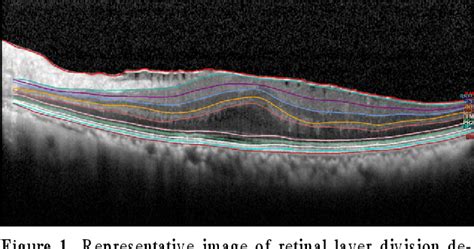Figure 1 From The Thickness Of Each Retinal Layer And Visual Acuity After Vitrectomy In