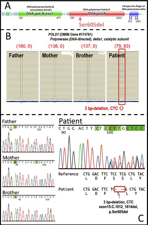 Figure 2 From Definitive Diagnosis Of Mandibular Hypoplasia Deafness