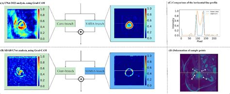 Figure 1 From Swin Deformable Attention Hybrid U Net For Medical Image Segmentation Semantic