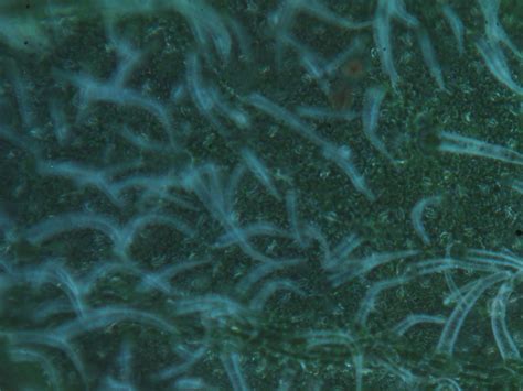 Stomata Density Object Detection Model By Stomata Group