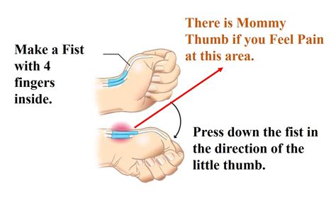 What Is A Mummy Thumb How To Ease Mommy Thumb 【tcm Chong】 愿景中医