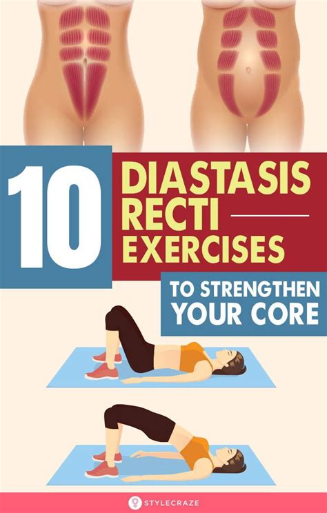 10 Exercises For Diastasis Recti That Strengthen Your Core Artofit