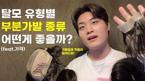 가발업체 직원이 알려주는 탈모 유형별 남자가발 종류 Feat 가격 Youtube