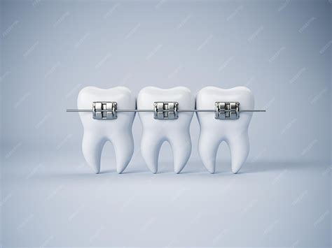 Premium Photo Teeth With Or Without Braces Arch Braces Without Teeth Orthodontic Dentistry The