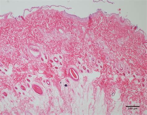 Lbms Projects Vascularized Tissue Engineering