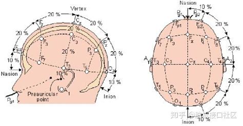 10 20国际标准导联系统 知乎