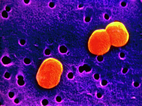Acinetobacter Calco Aceticus Bacteria Photograph By Science Photo