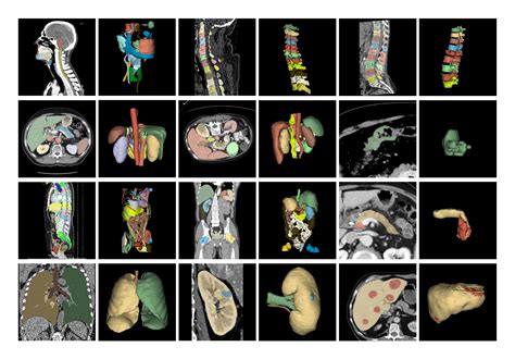 Goodbaibai88 M3d Seg · Datasets At Hugging Face