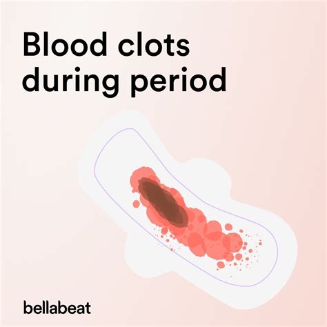 Blood Clots During Period Are They Normal What Are The Causes And