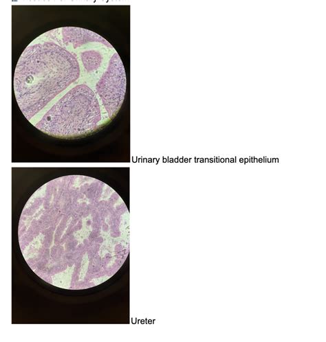 Urinary System Histology Diagram Quizlet