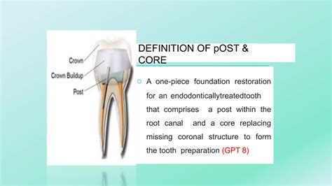 Restoration Of Endodontically Treated Teeth Pptx