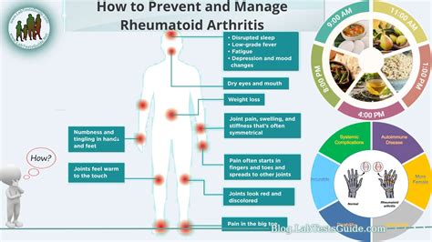 Rhumatoid Arthritis Test