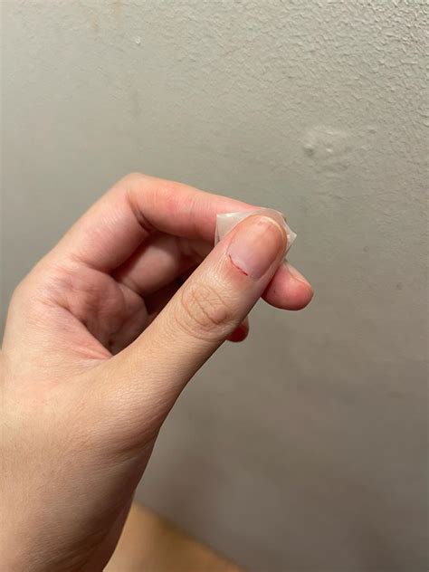 Womans Cuticle Started Bleeding But Finger Spa Manicurist Says “oh