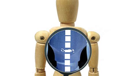 Things To Know About Compression Fractures SEPSC