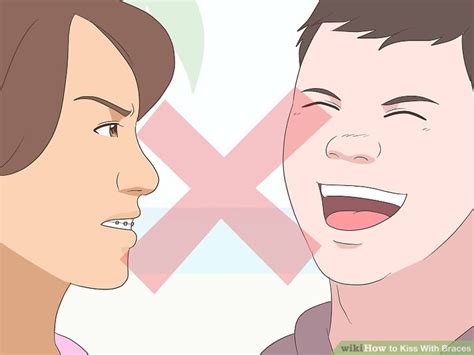 How To Kiss With Braces 9 Steps With Pictures Wikihow