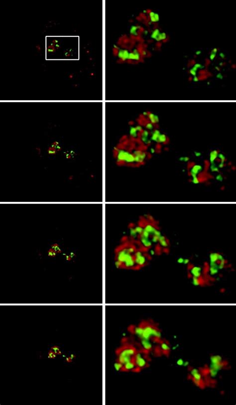Three Dimensional Deconvolution Shows Minimal Overlap Between Download Scientific Diagram