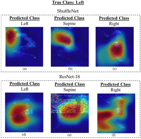 In Bed Posture Classification Using Deep Neural Network