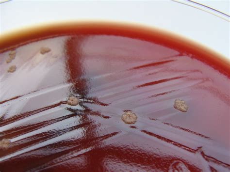 Flickriver Most Interesting Photos Tagged With Actinomyces