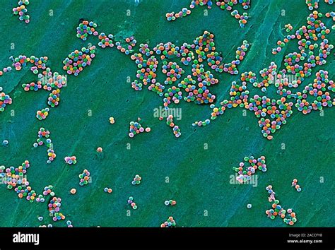 Mrsa Bacteria Coloured Scanning Electron Micrograph Sem Methicillin Resistant Staphylococcus