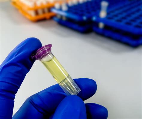 Detection Of Mycobacterium Tuberculosis Genolife
