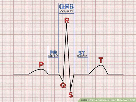 How To Calculate Heart Rate From ECG Steps With Pictures