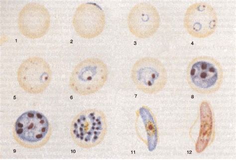 Medissante Plasmodium Malária